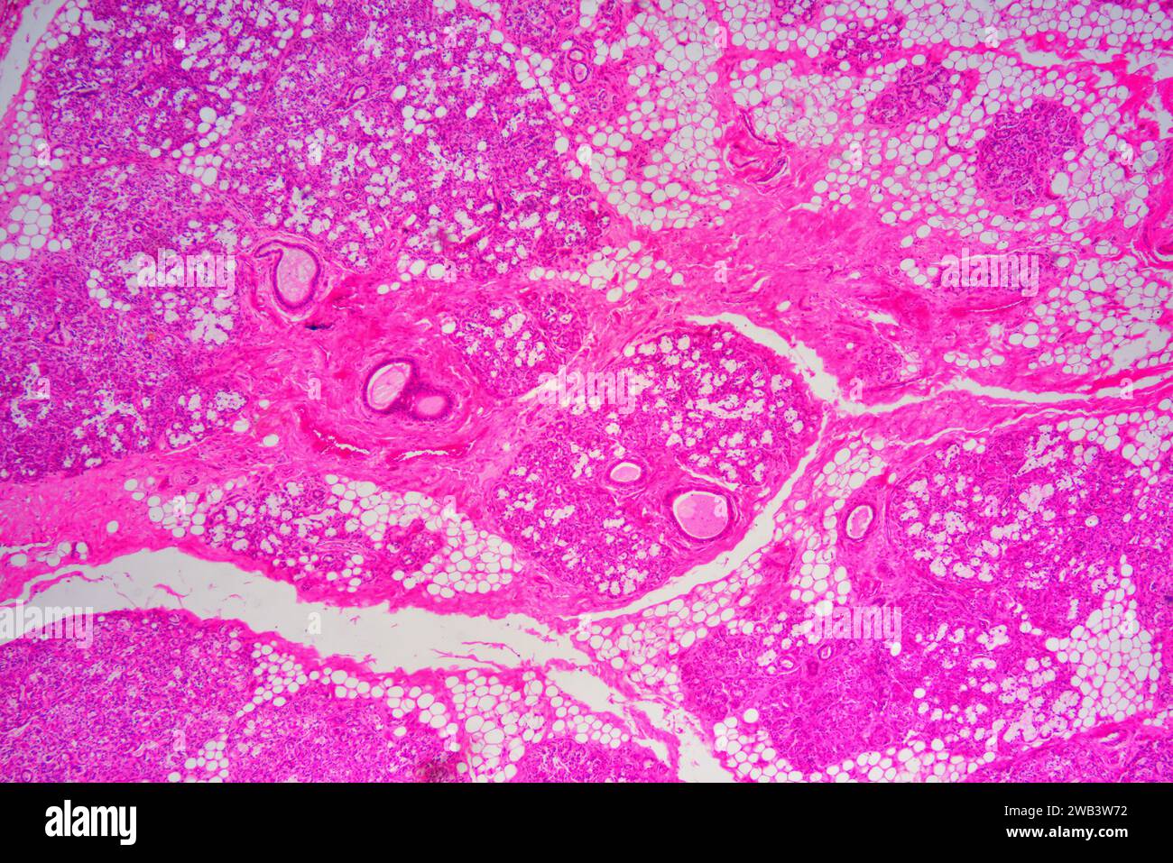 Human umbilical cord mucosa showing: mucous glands, loose conective ...