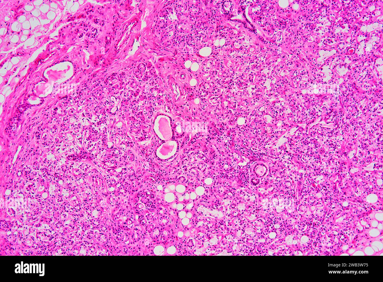 Mucous Connective Tissue Umbilical Cord