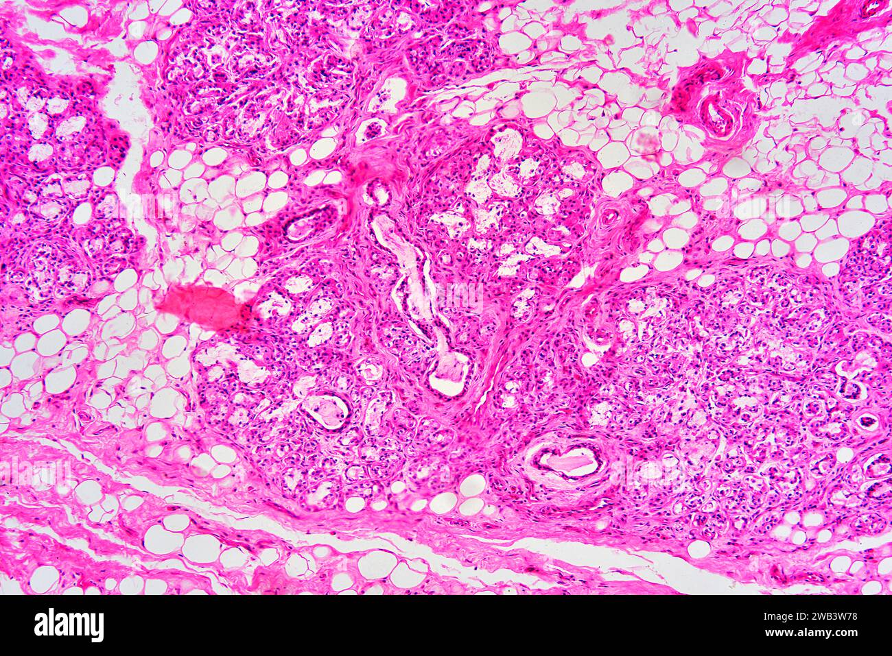 Human umbilical cord mucosa showing: mucous glands, loose conective ...