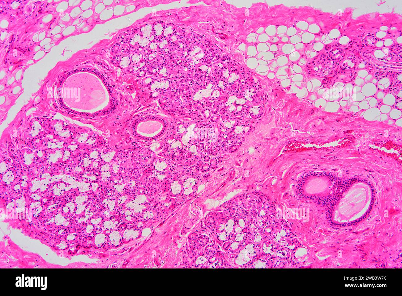 Mucous Connective Tissue Umbilical Cord