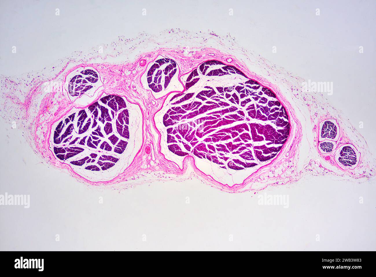 Human nerve fibers with epineurium and perineurium. X25 at 10 cm wide ...