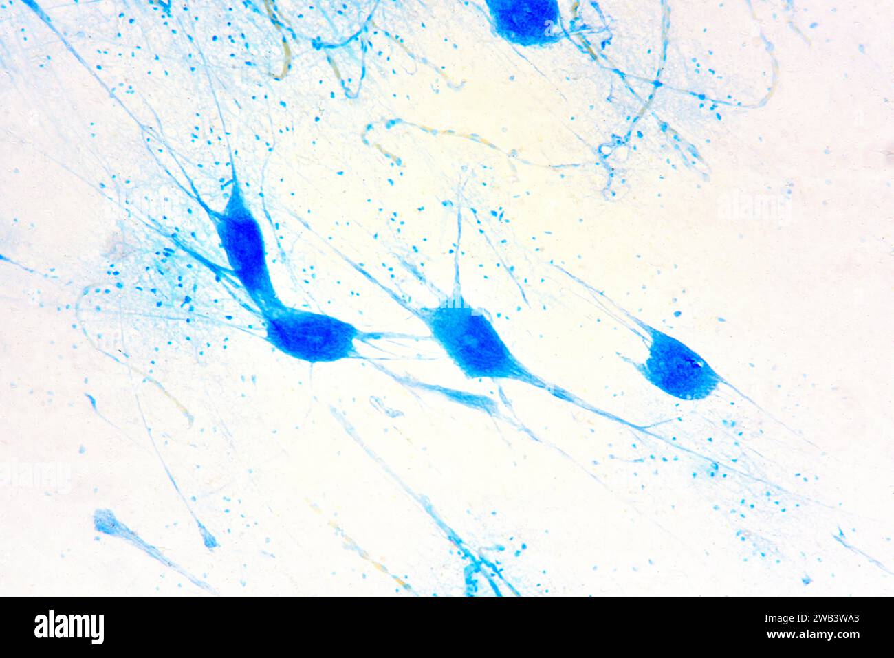 Human motor neurons. X75 at 10 cm wide Stock Photo - Alamy