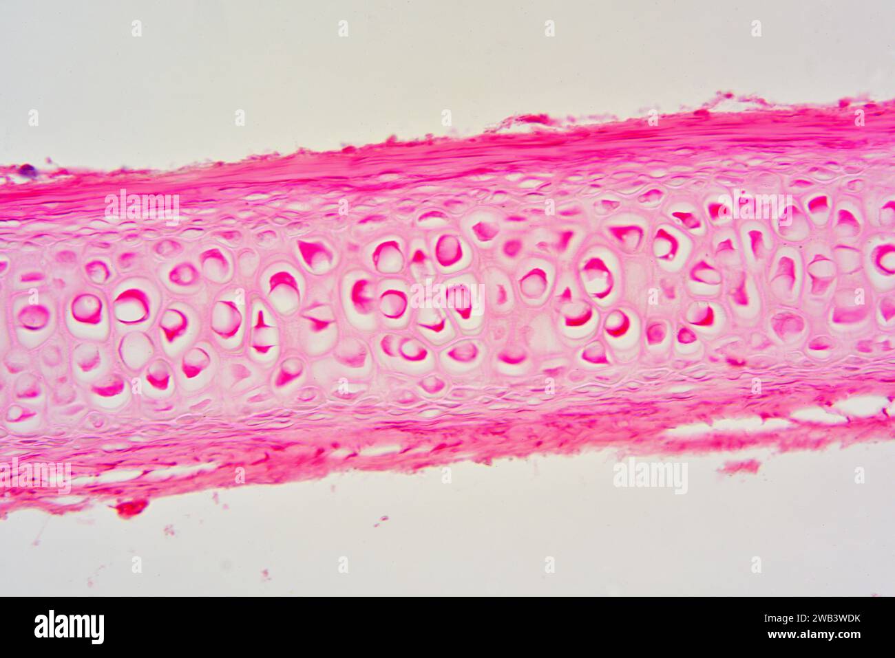 Human decalcified bone hi-res stock photography and images - Alamy