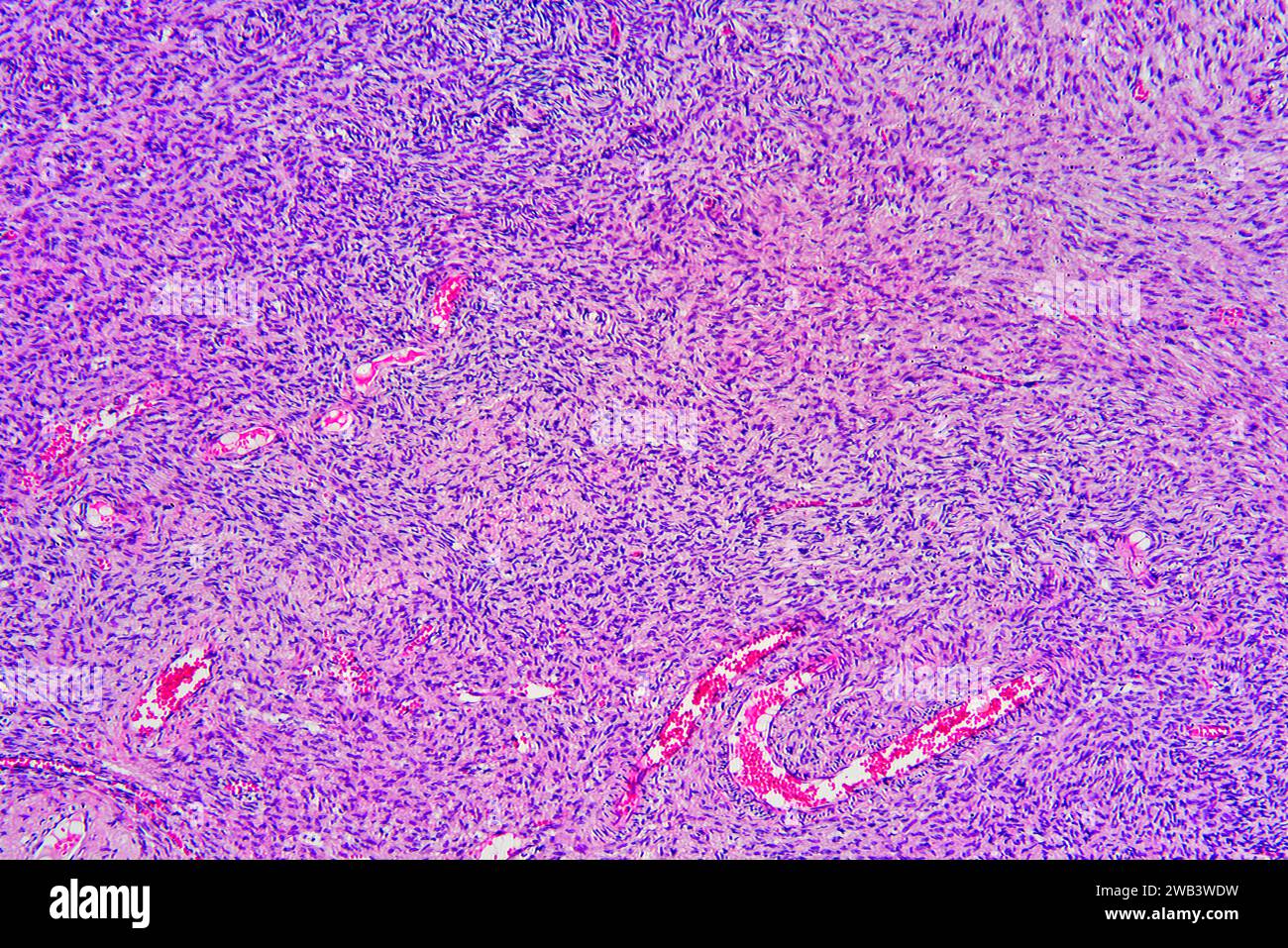 Aparato reproductor hi-res stock photography and images - Alamy