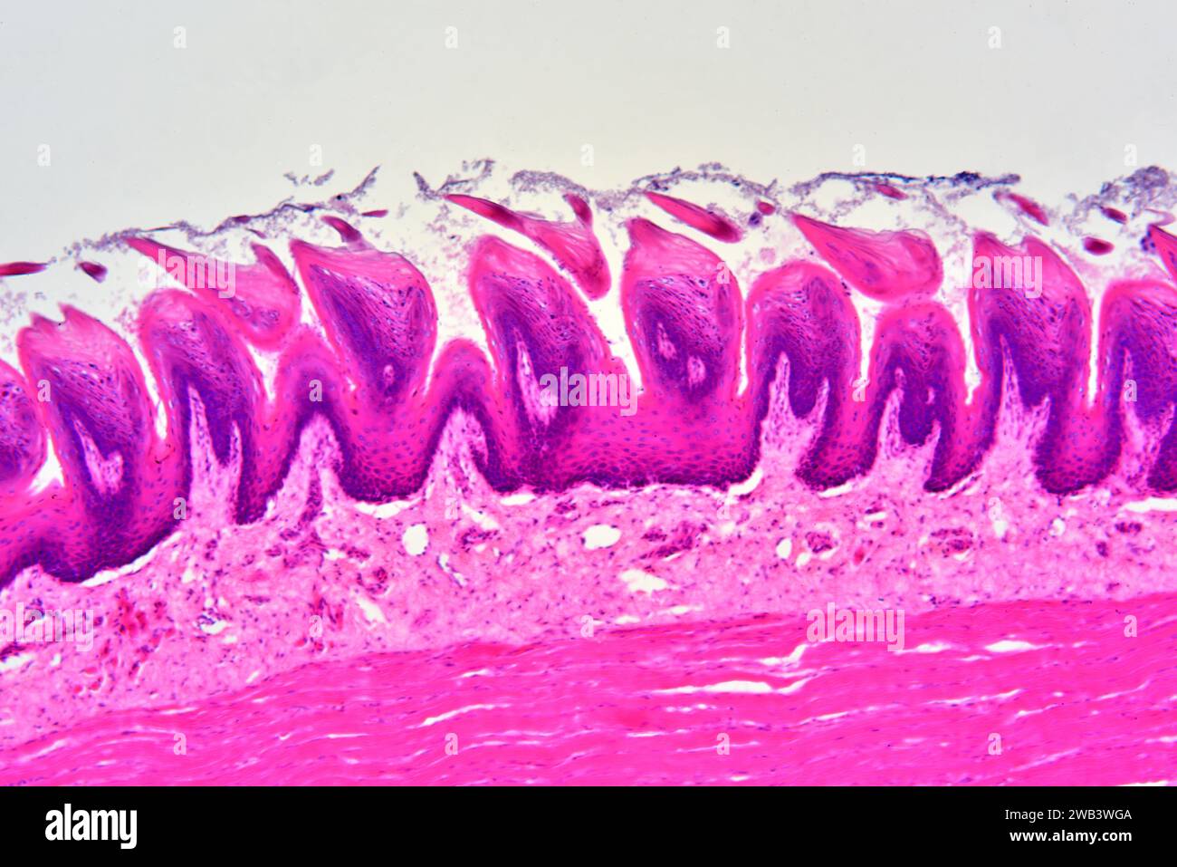 Filiform Papillae Histology