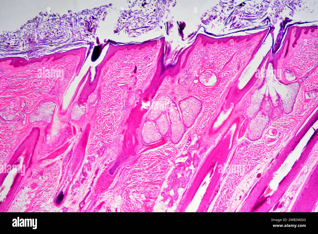 Sebaceous glands in human skin with hair follicles. X25 at 10 cm wide ...