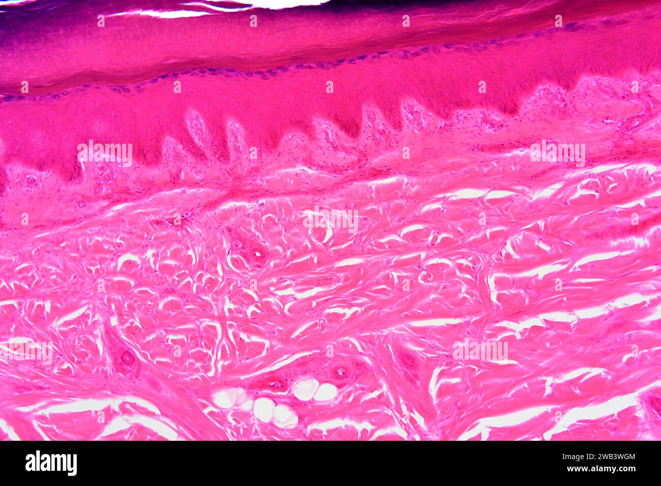Human skin showing from top to bottom: epidermis with stratum corneum ...