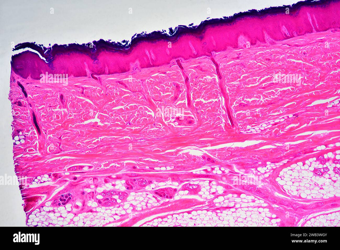 Human skin showing epidermis, dermis with sweat glands, adipose tissue ...