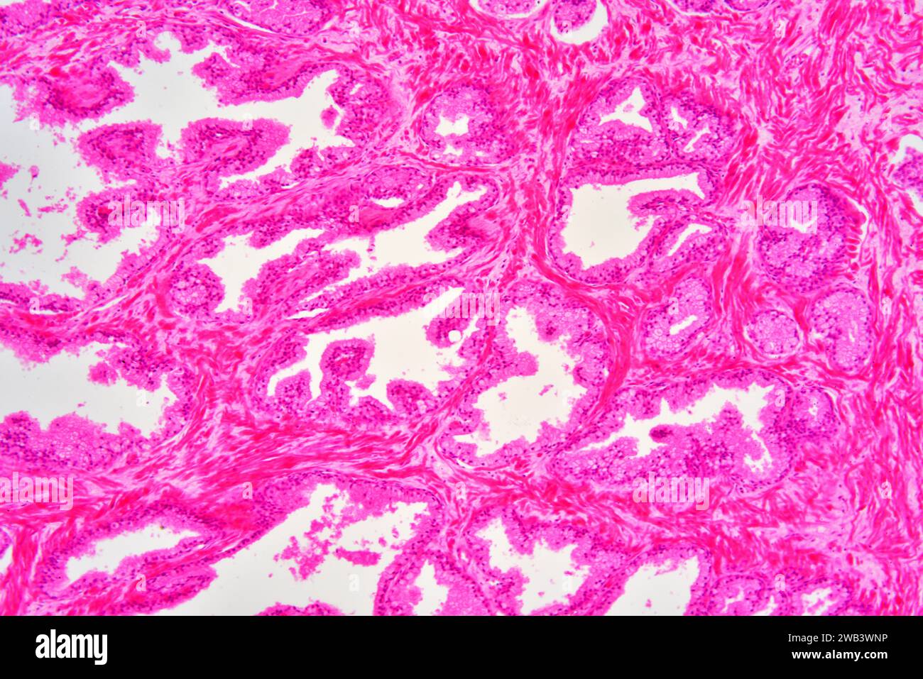 Epithelial tissue hi-res stock photography and images - Alamy