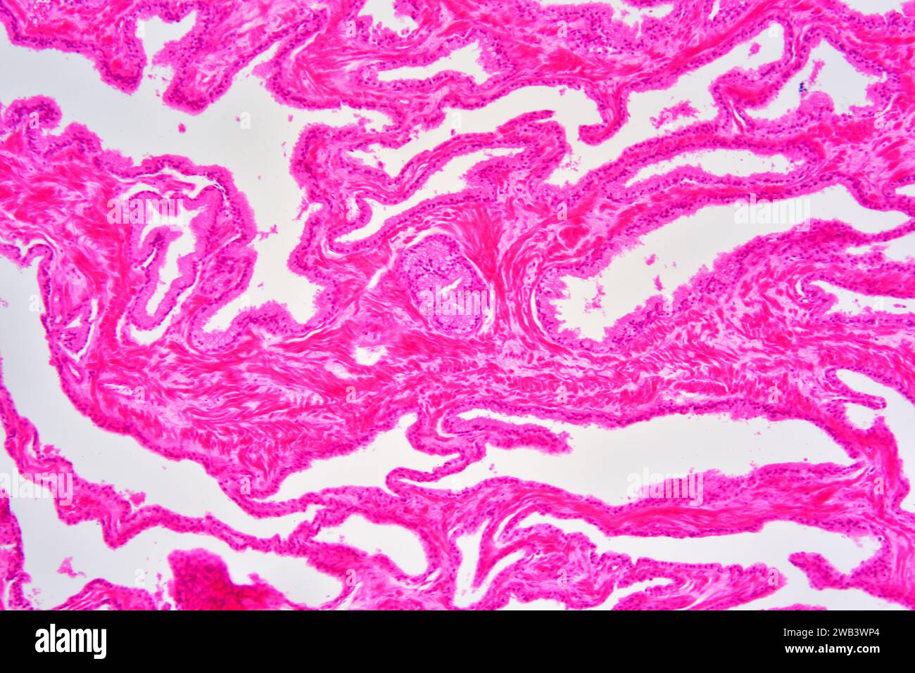 Epithelial cells micrograph hi-res stock photography and images - Alamy