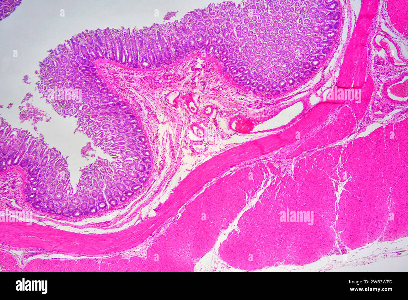 Human rectum with mucosa, intestinal glands, blood vessels and muscular ...