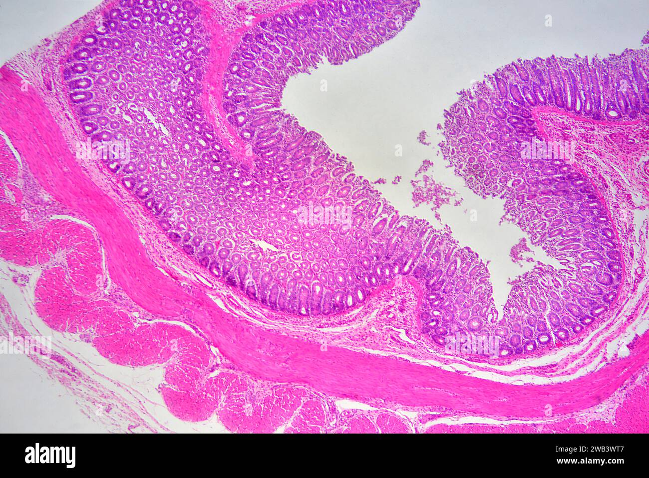 Human rectum showing from top to bottom: mucosa with intestinal glands ...