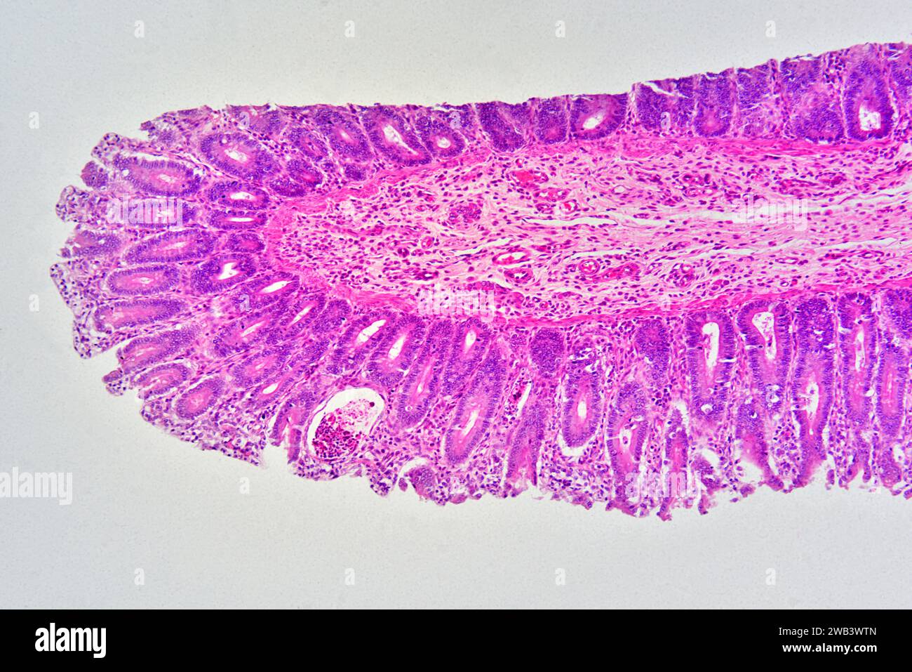 Human rectum with mucosa, intestinal glands, lamina propria and ...