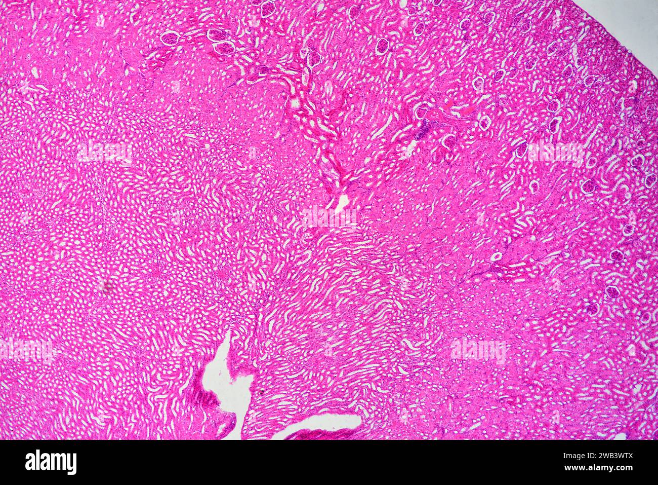 Human kidney section showing renal cortex with glomeruli, Malpighian ...