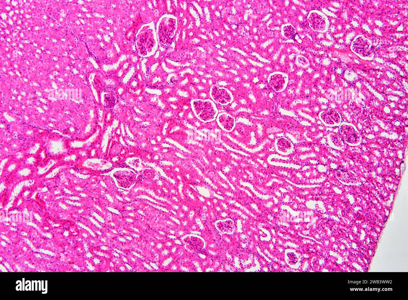 Human kidney section showing renal cortex with glomeruli, Malpighian corpuscles and nephrons and ...