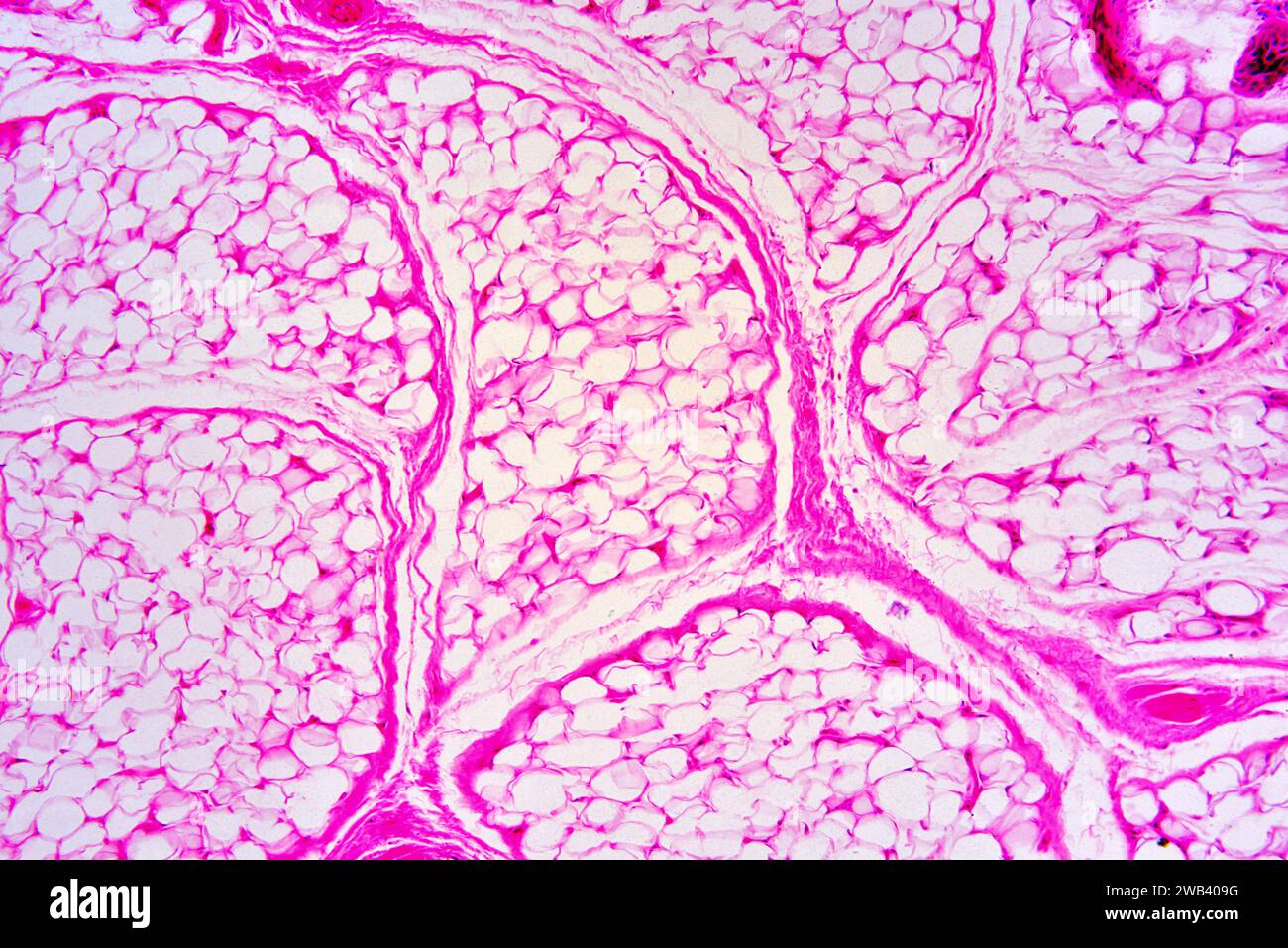 Adipose tissue micrograph hi-res stock photography and images - Alamy