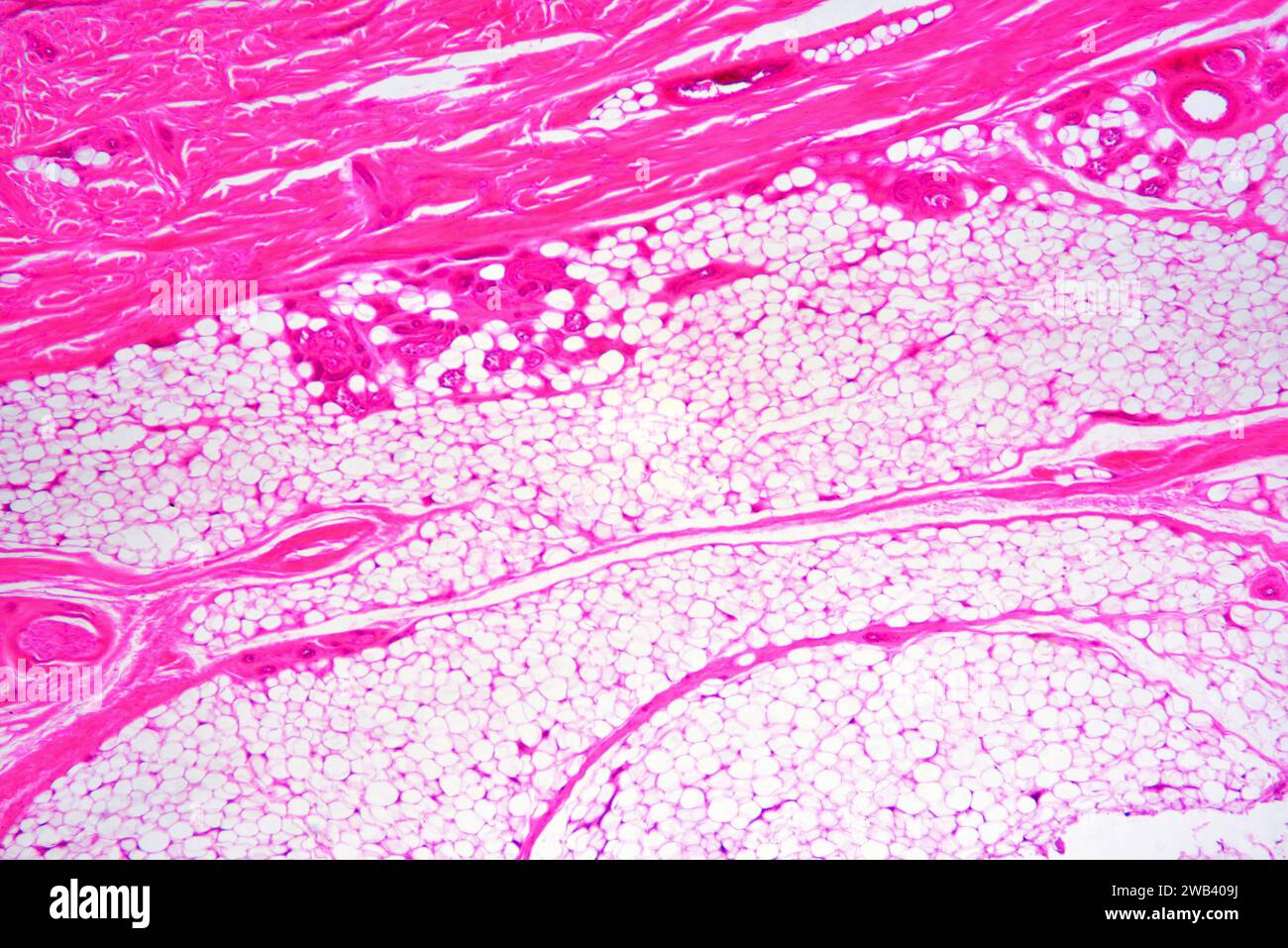 Human adipose tissue of skin. X25 al 10 cm wide Stock Photo - Alamy