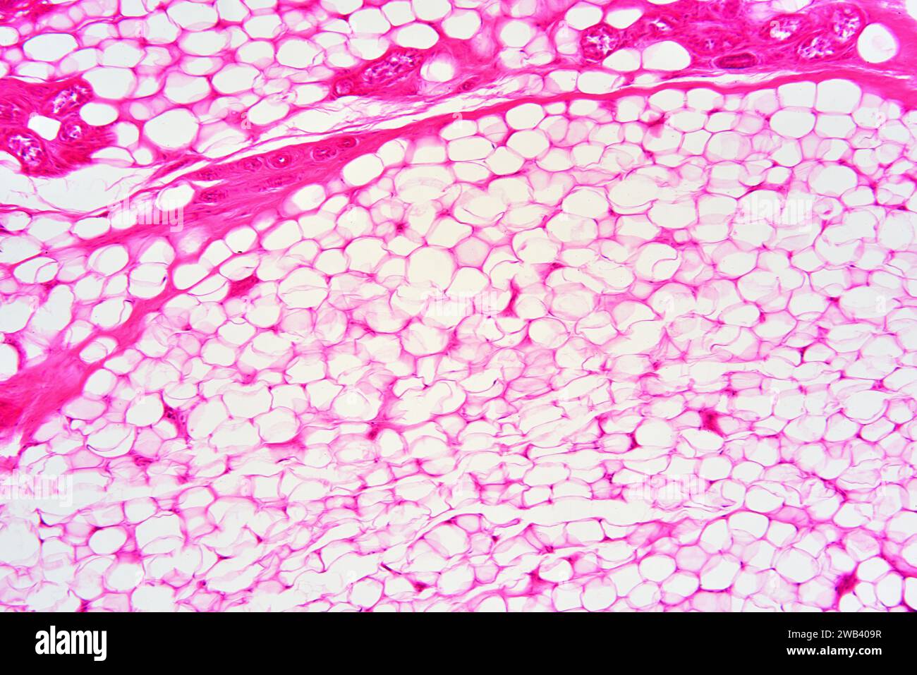 Human adipose tissue of skin. X75 al 10 cm wide Stock Photo - Alamy