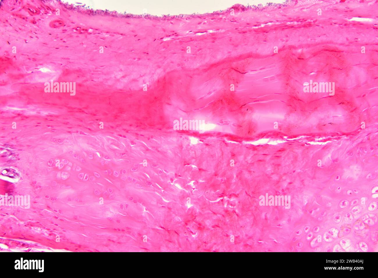 Human dense connective tissue. X125 at 10 cm wide Stock Photo - Alamy