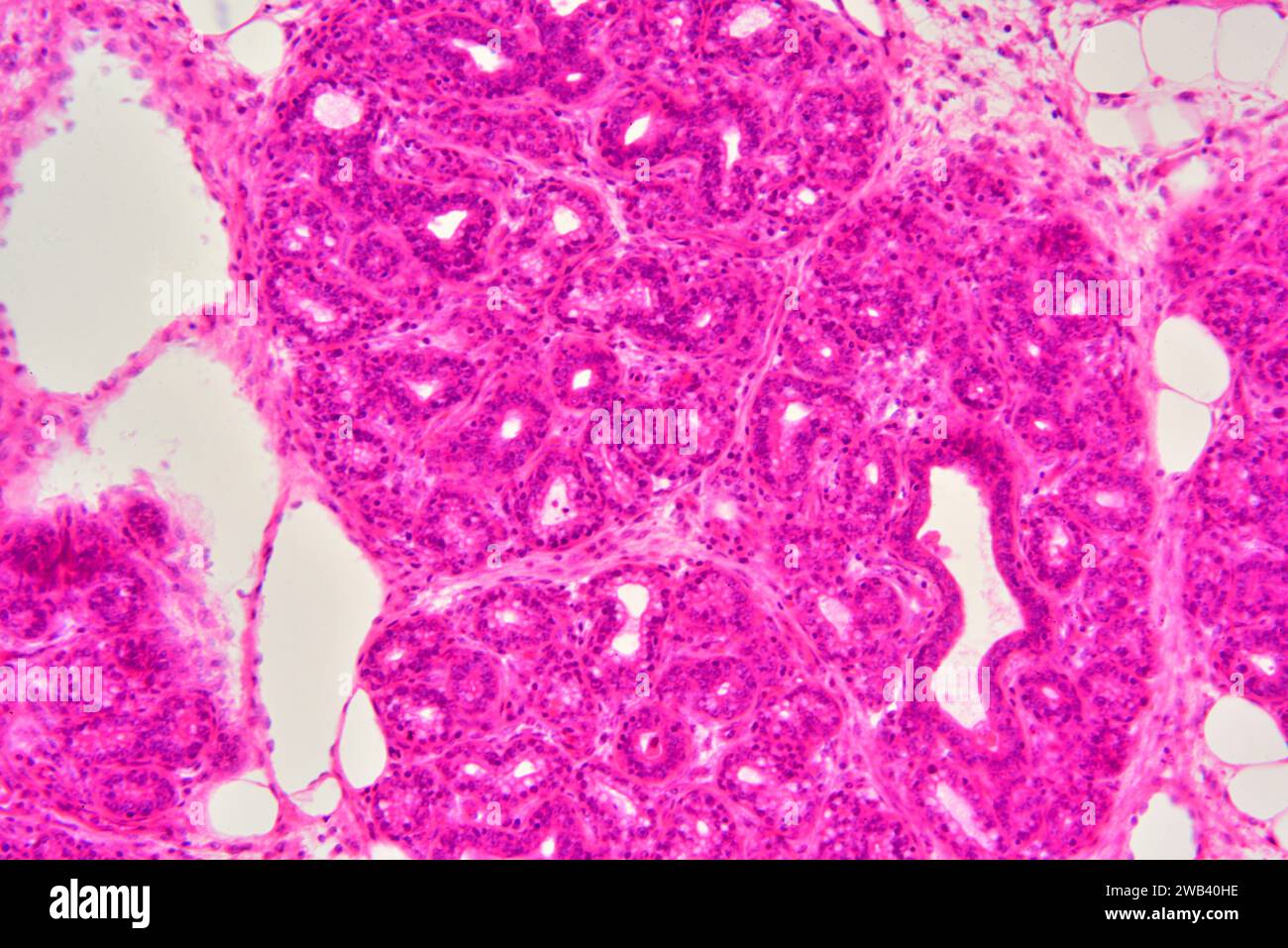 Human glandular epithelium hi-res stock photography and images - Alamy