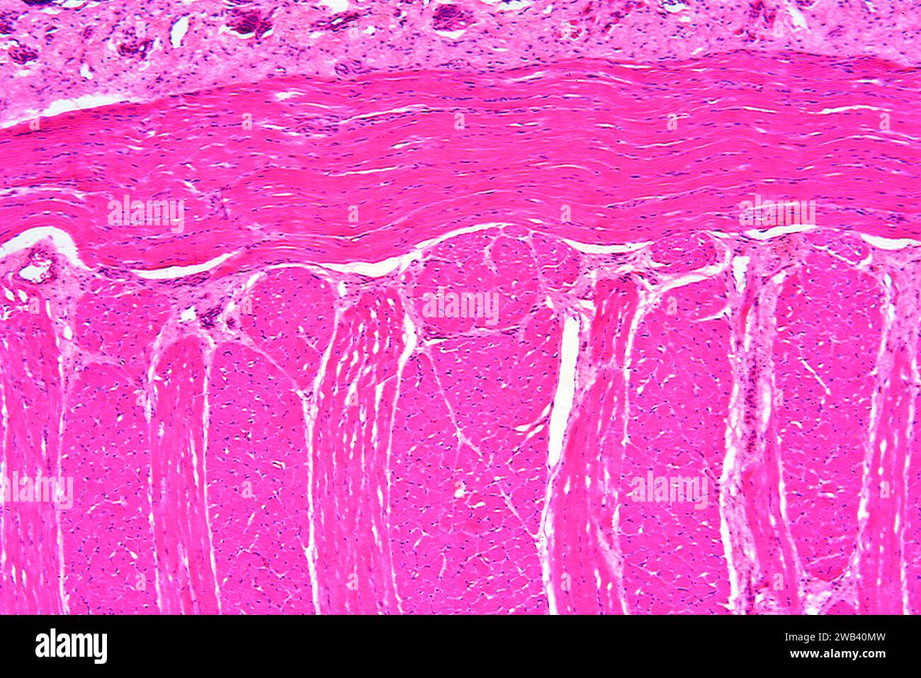 Tongue section showing from up to down: connective tissue and striated ...