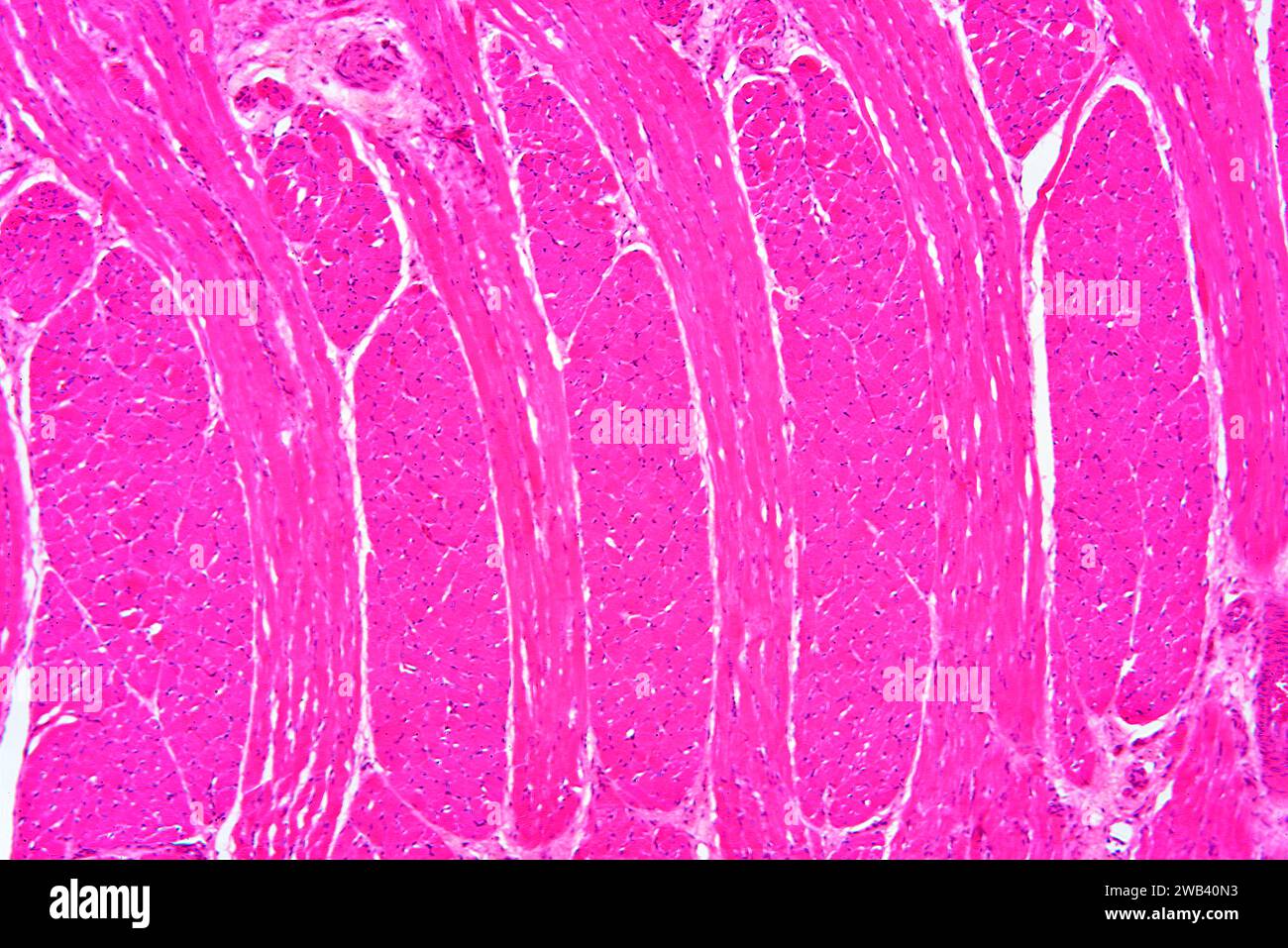 Skeletal muscle fibers hi-res stock photography and images - Alamy