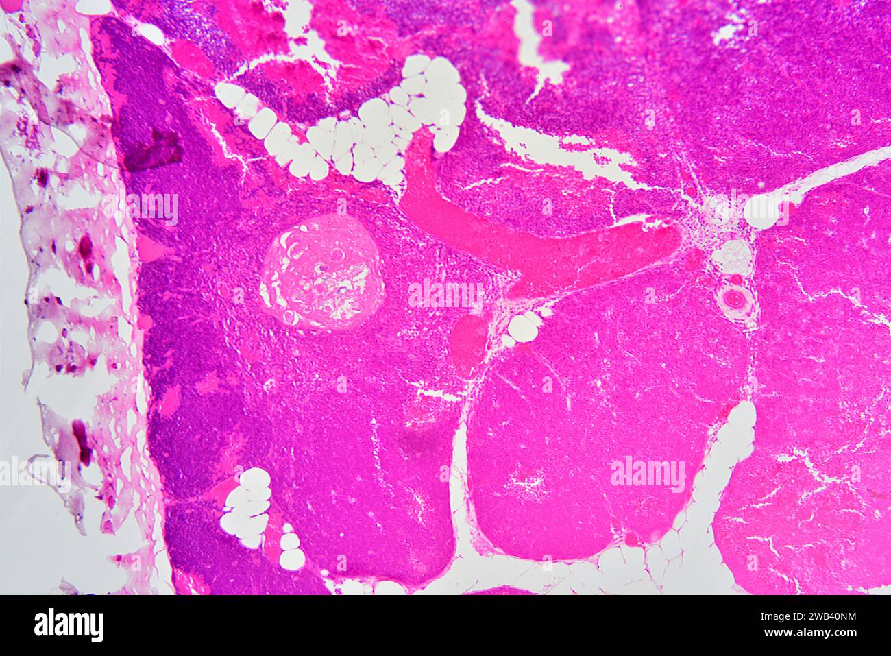Human thymus section with Hassall corpuscle. X75 at 10 cm wide Stock ...