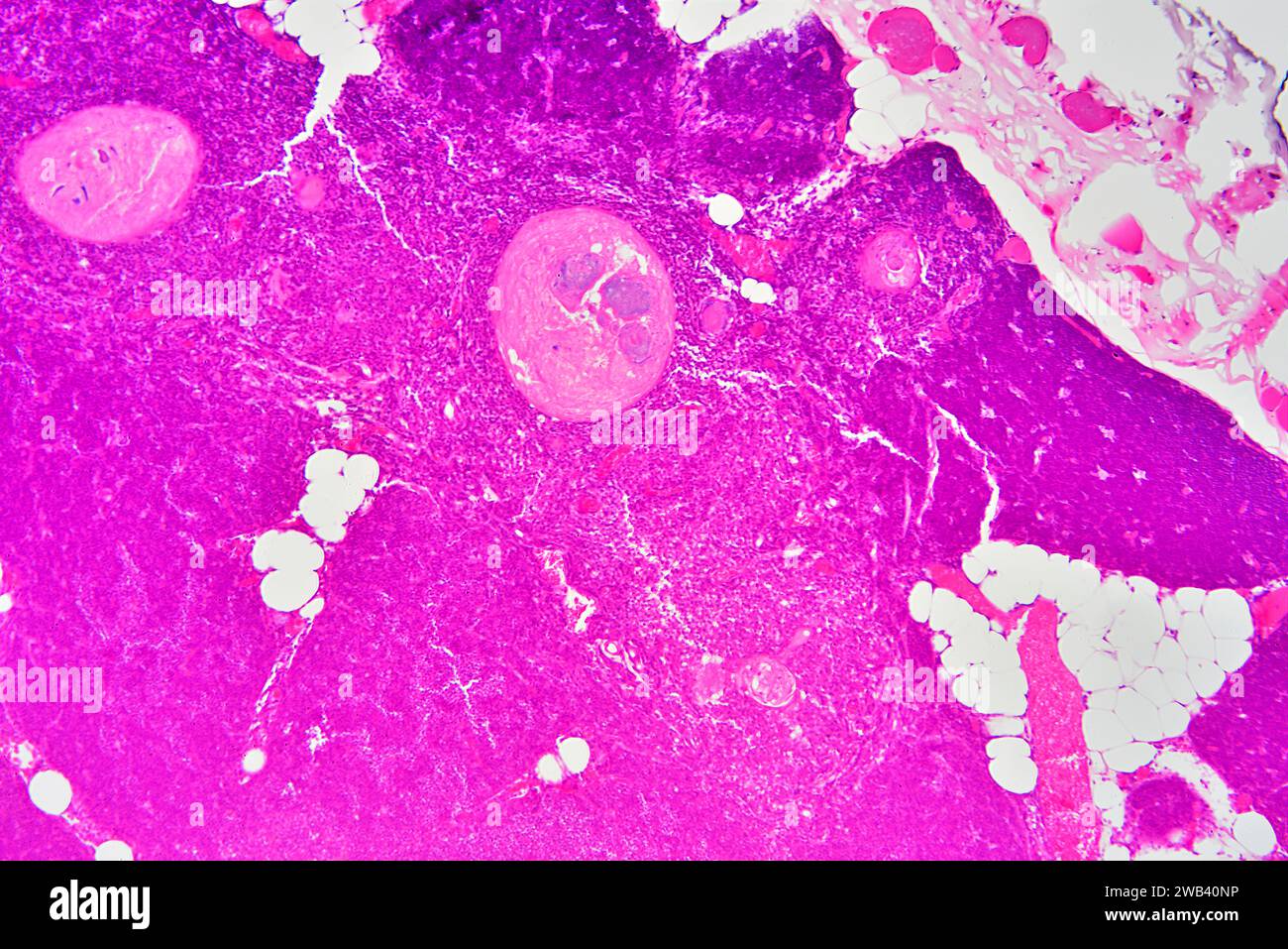 Human thymus section with Hassall corpuscles. X75 at 10 cm wide Stock ...