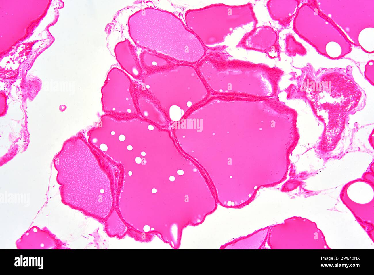 Human thyroid gland section showing colloid and follicular cells. X75 ...