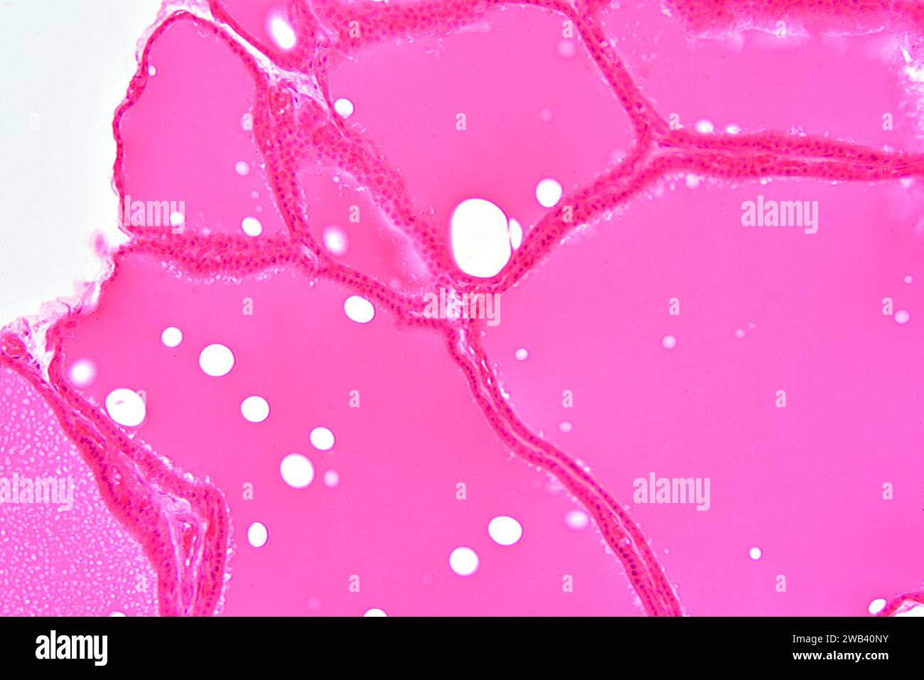 Human thyroid gland section showing colloid and follicular cells. X125 ...