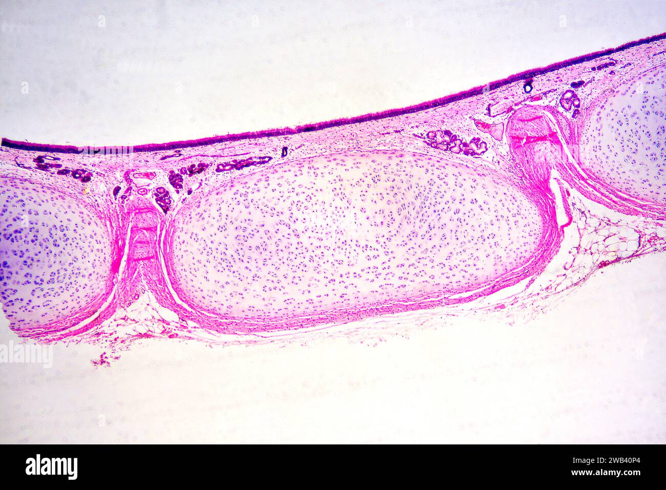 Human epiglottis section showing from up to down: respiratory ...