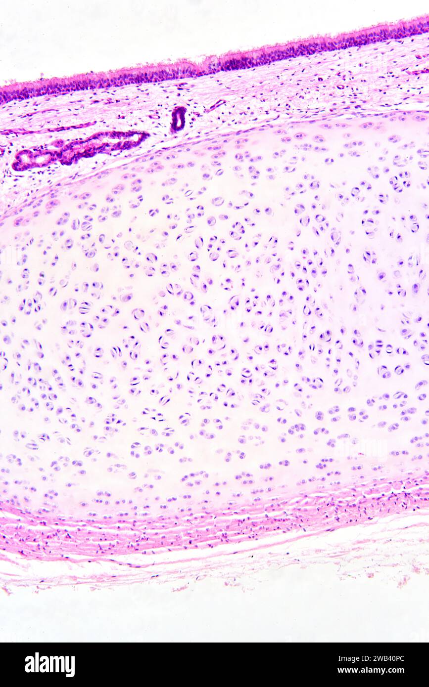 Elastic Cartilage Histology Ear