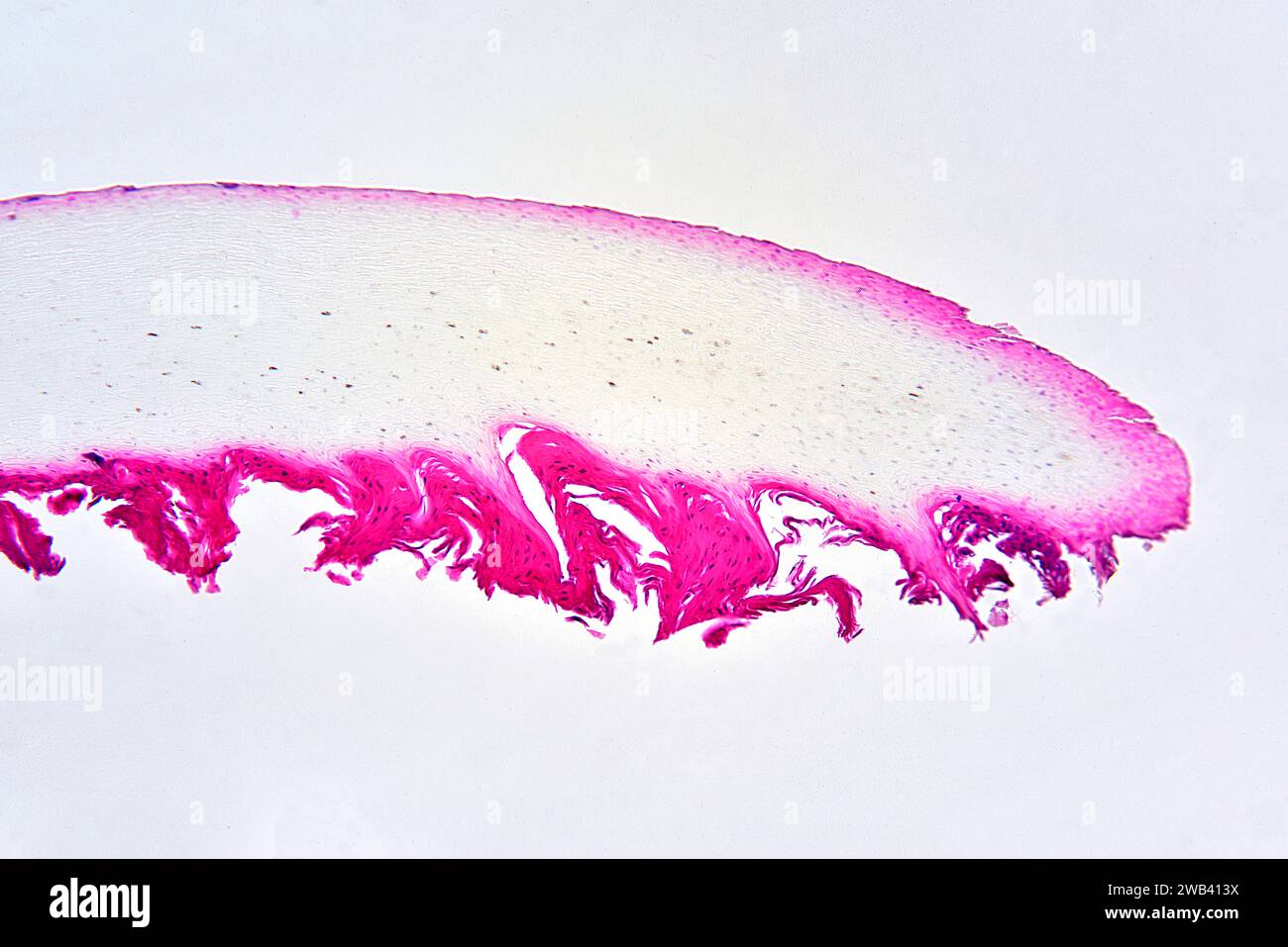 Human nail section showing dermis, nail matrix and nail plate of hard ...