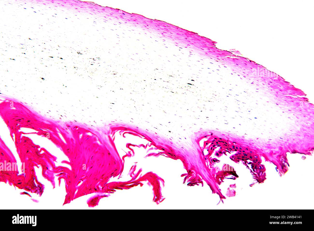 Human nail section showing dermis, nail matrix and nail plate of hard ...