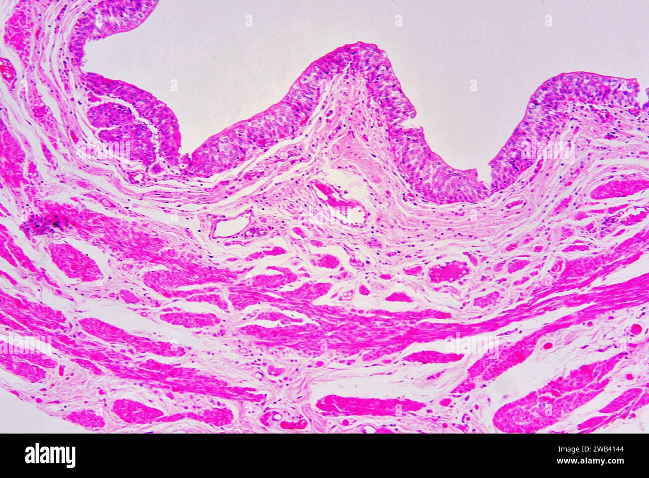 Human ureter section showing from up to down: transitional epithelium ...