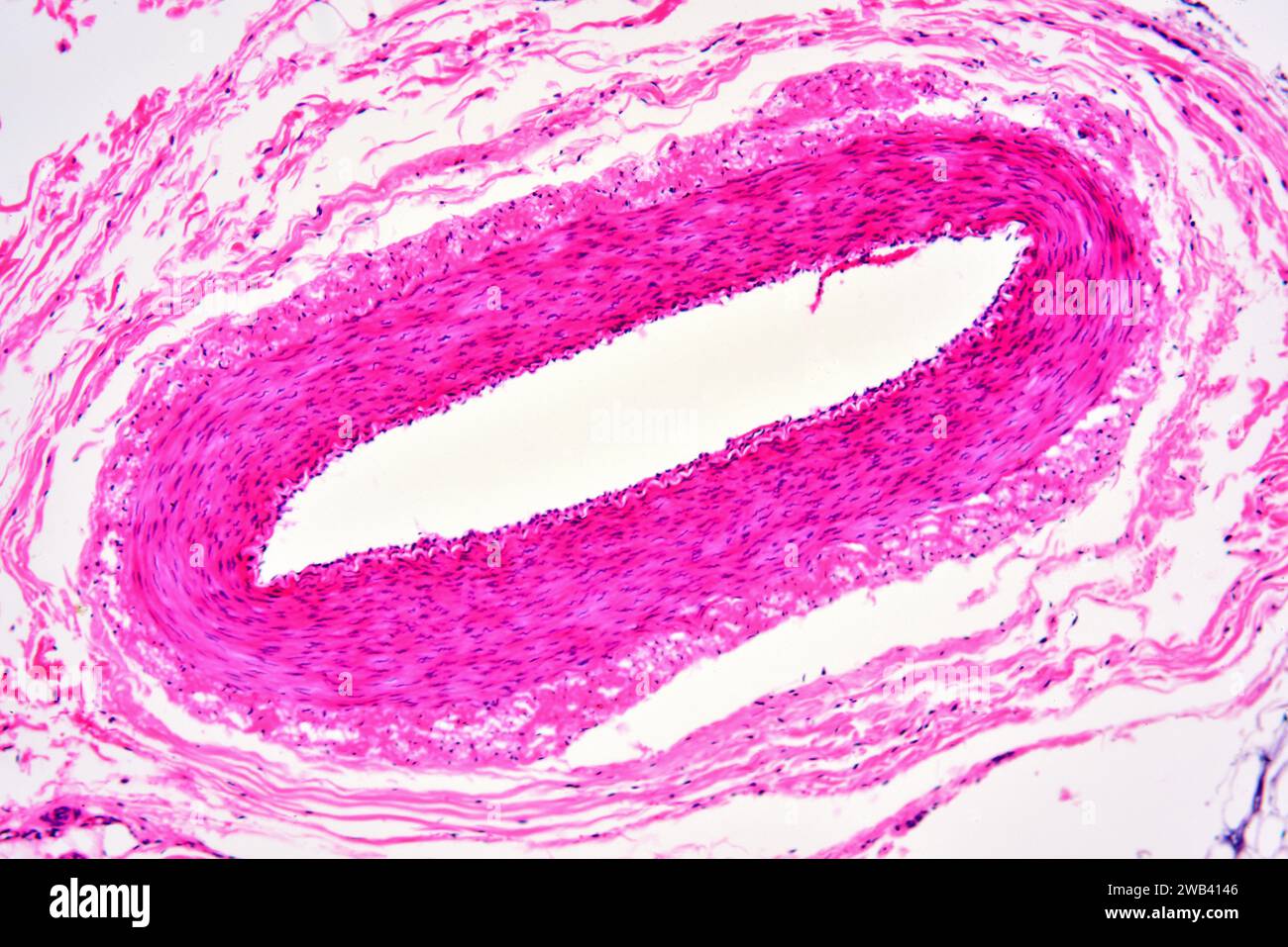 Human arteriole showing from inside to outside: endothelium, smooth ...