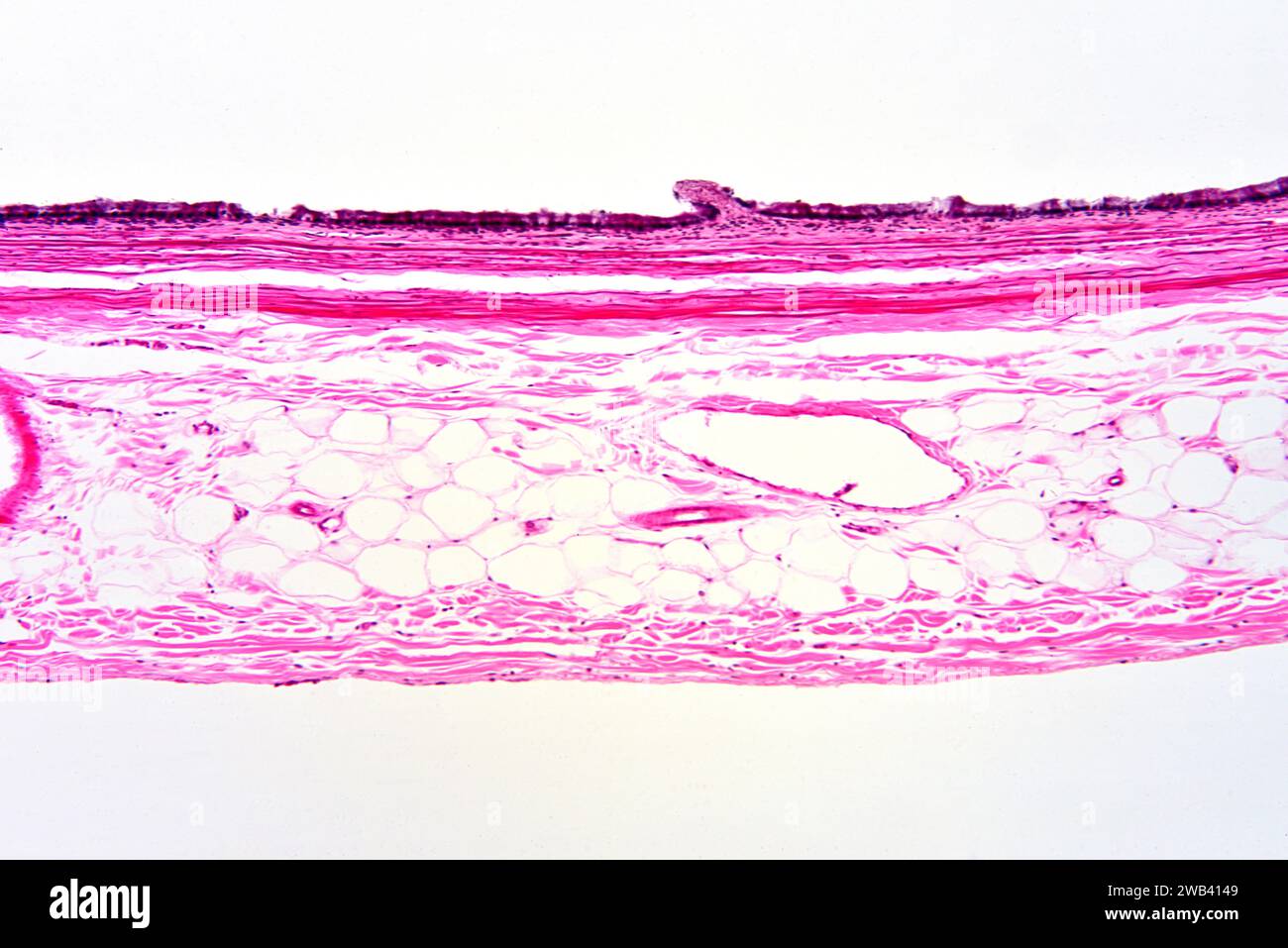 Human Gallbladder Wall Section Showing From Up To Down Simple Columnar