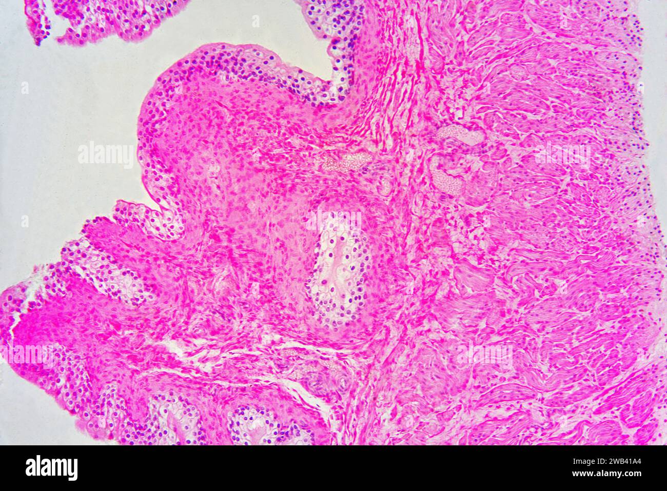 Urinary bladder with urothelium (transitional epithelium), connective ...