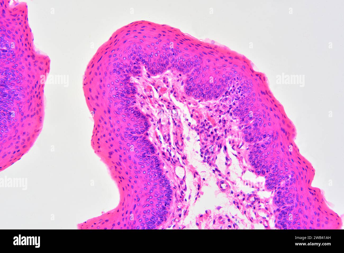 Stratified epithelium hi-res stock photography and images - Alamy