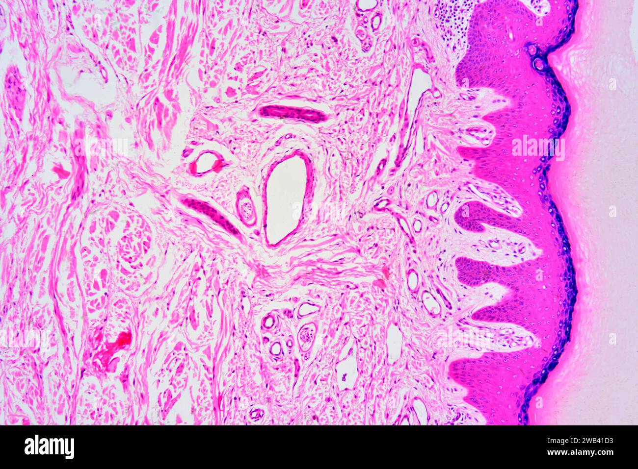 Human skin showing from right to left: epidermis (squamous keratinized ...