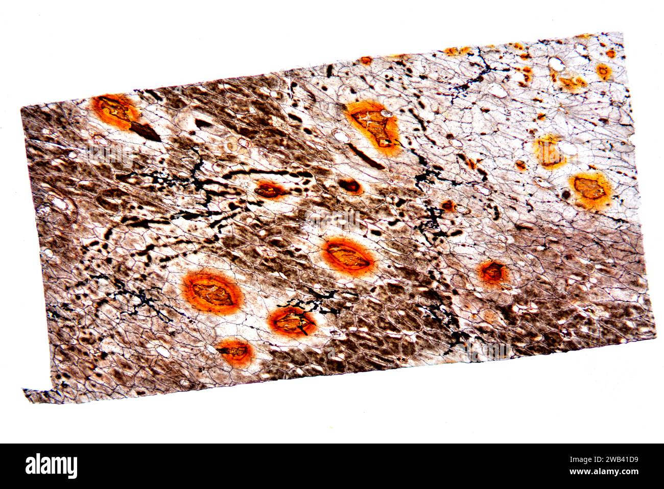 Simple squamous epithelium hi-res stock photography and images - Alamy