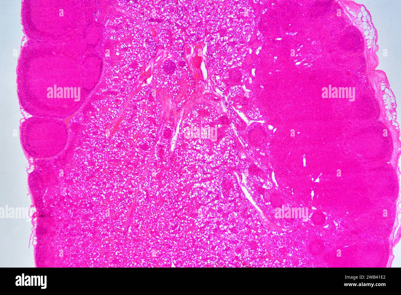 Lymph node or lymph gland with capsule, lymphoid nodule and trabeculae ...