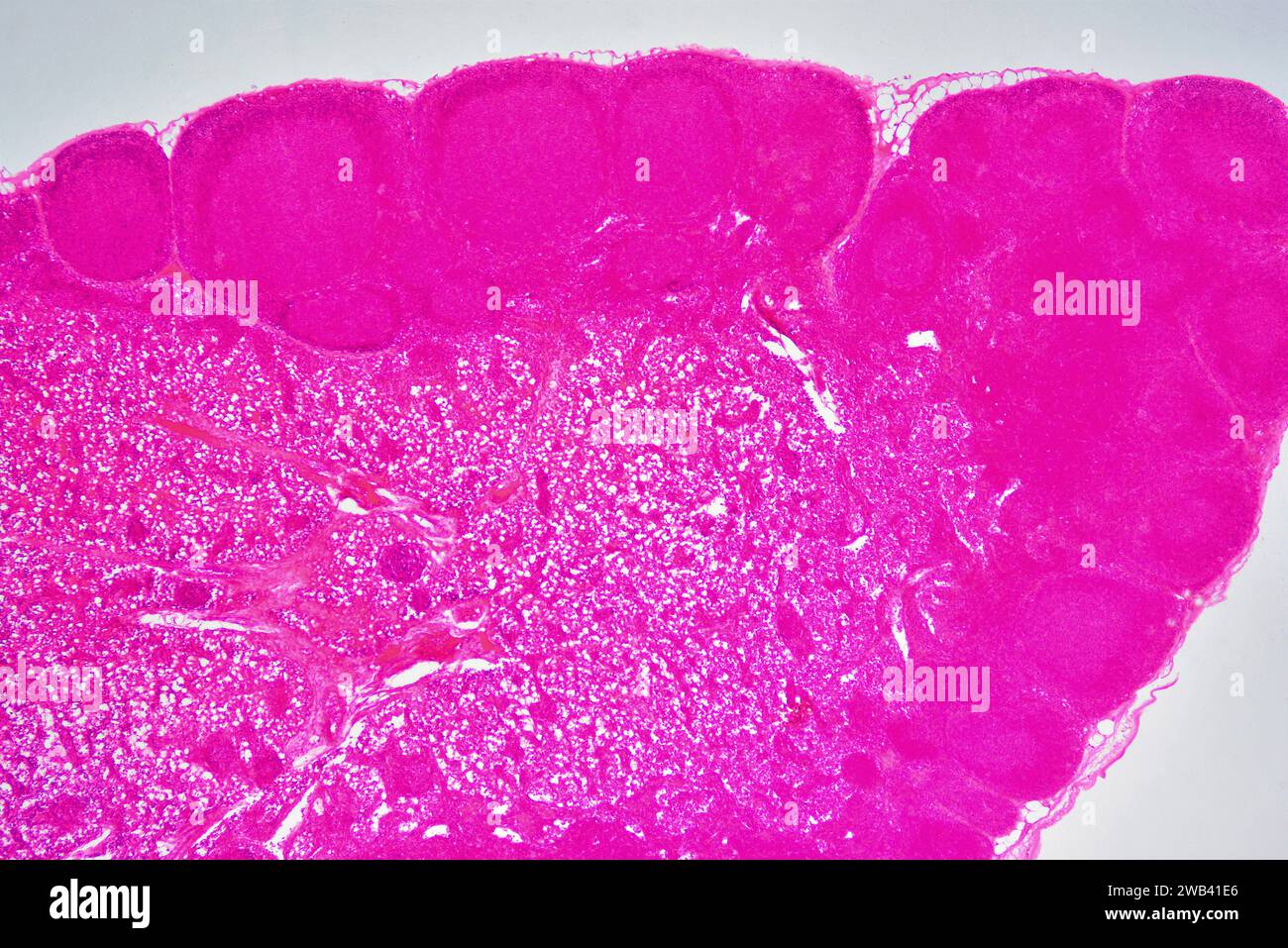 Lymph node or lymph gland with capsule, lymphoid nodule and trabeculae ...