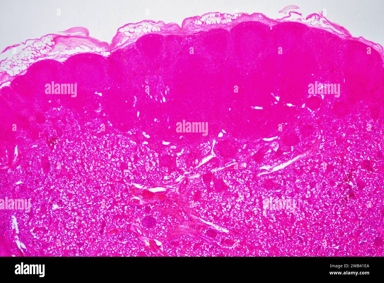 Lymph node or lymph gland with capsule, lymphoid nodule and trabeculae ...