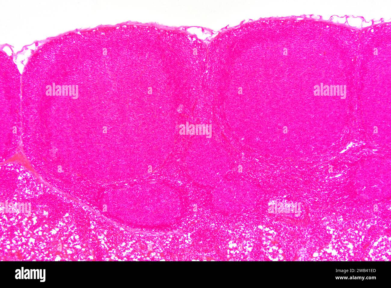 Lymph node or lymph gland with capsule, lymphoid nodule and trabeculae ...