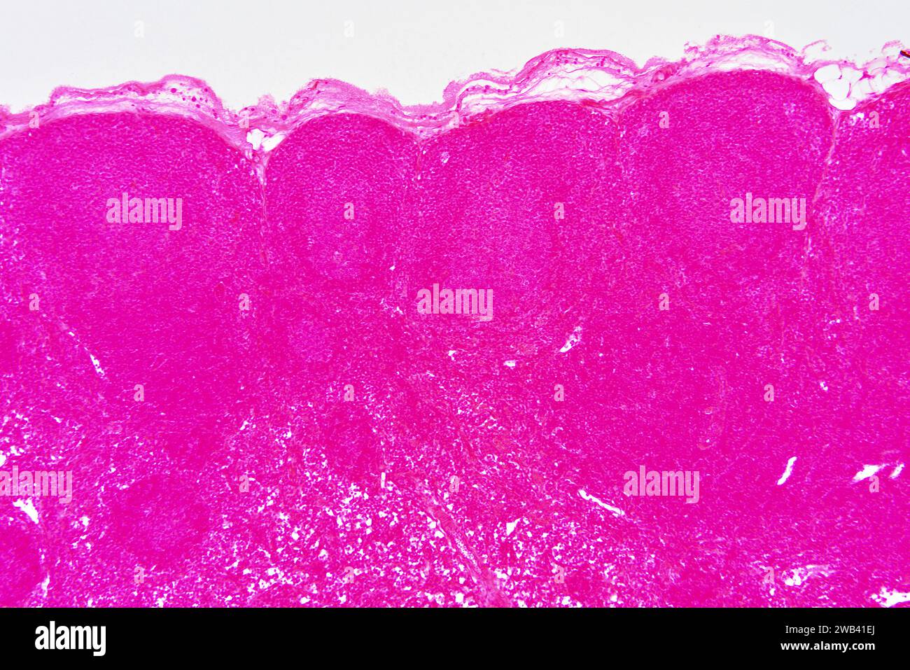 Lymph node or lymph gland with capsule, lymphoid nodule and trabeculae ...