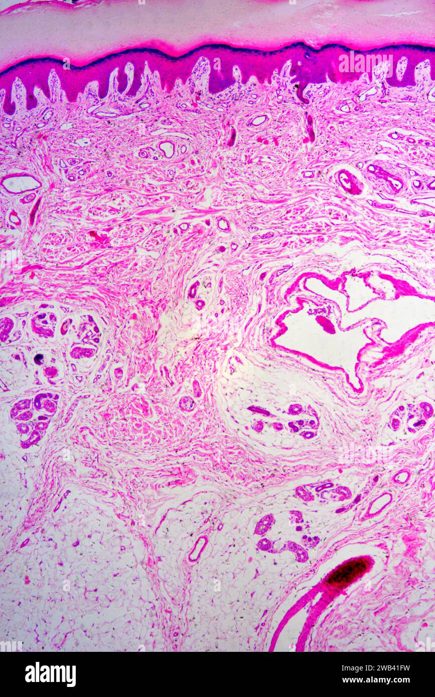 Human skin with epidermis and dermis with sweat gland. Photomicrograph ...