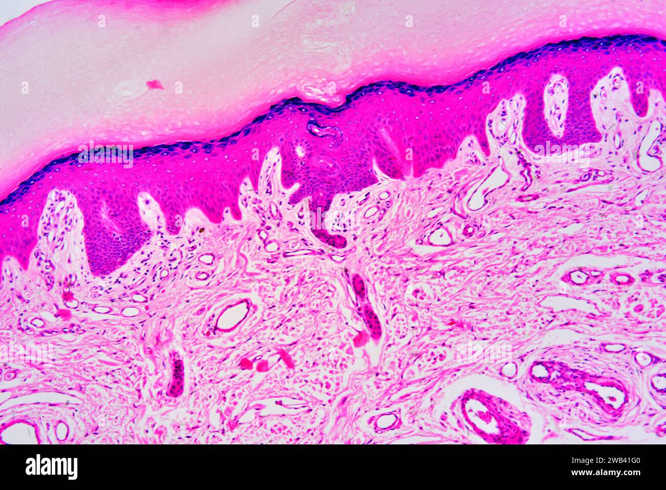 Human skin with epidermis and dermis with sweat gland. Photomicrograph ...