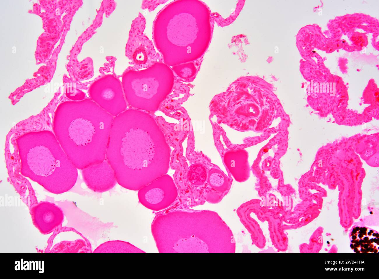 Aparato reproductor hi-res stock photography and images - Alamy