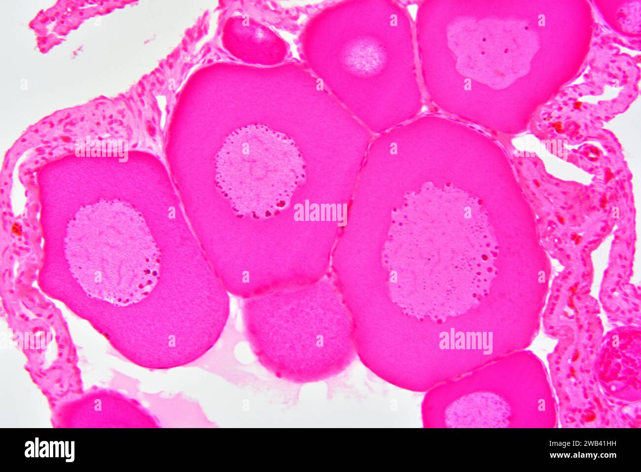Photomicrograph ovary hi-res stock photography and images - Alamy
